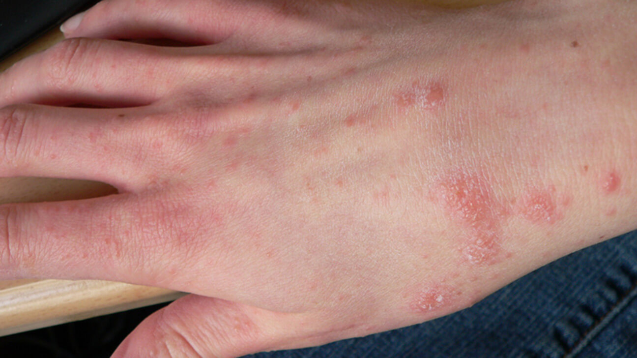 Is Your House Making You Sick Heres What You Can Do